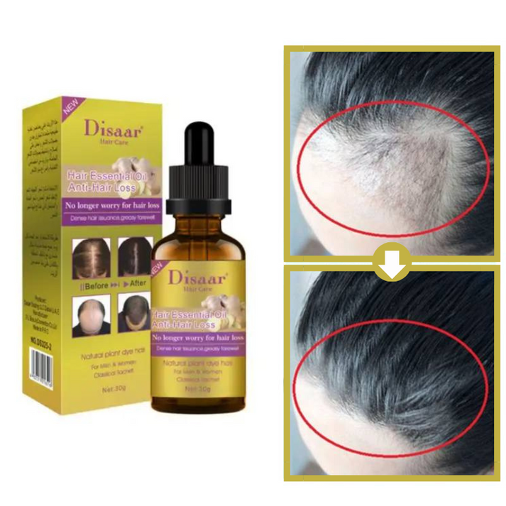 Disaar Hair Care Premium™ Aceite Anticaida Reparador Crecimiento ...